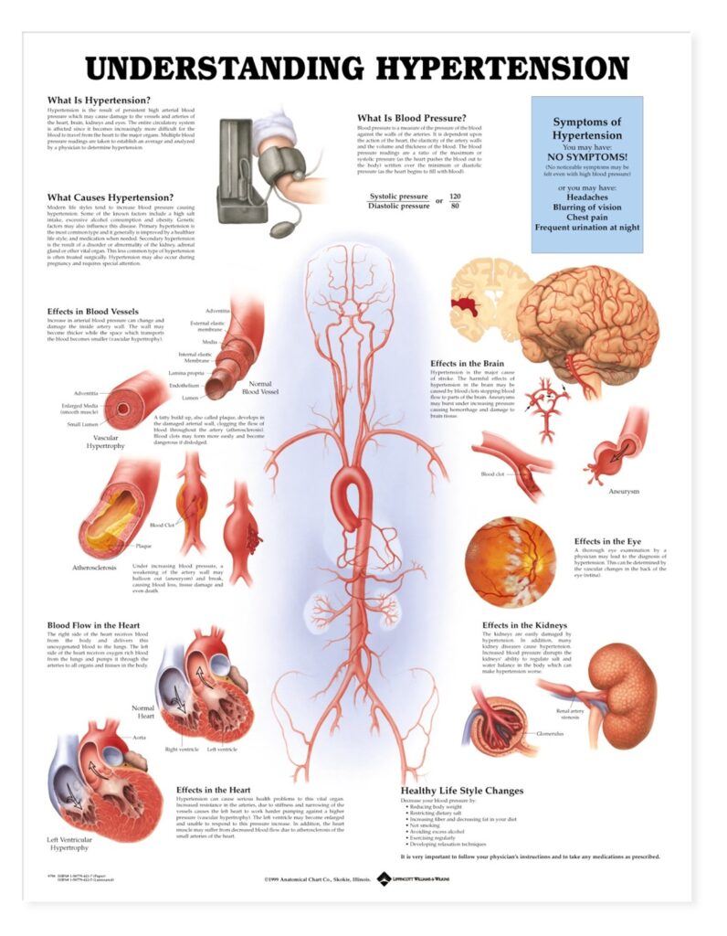Understanding Hypertension Anatomical Chart – Physio Needs